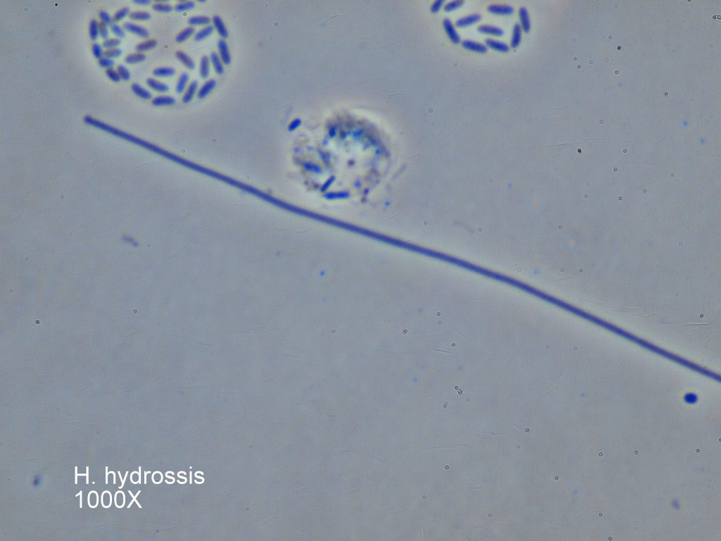 Filamentous Bacteria Gallery - 4G Environmental Corporation