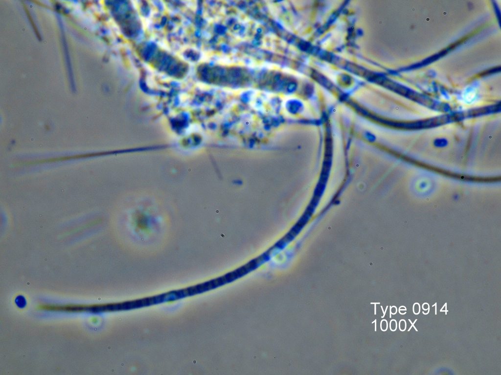 Filamentous Bacteria Gallery - 4G Environmental Corporation